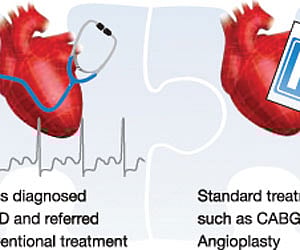 Shockwave proves to be a boon to cardiology