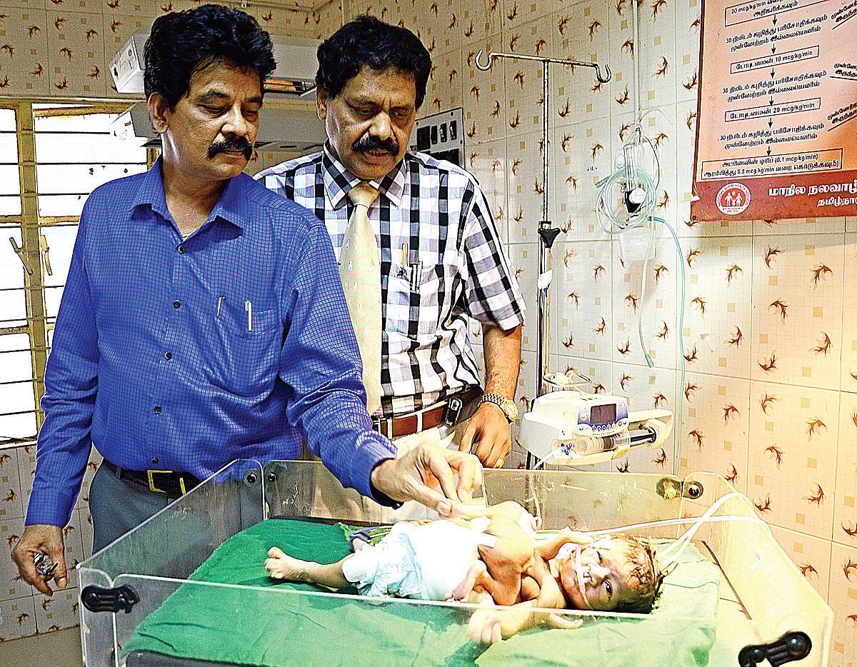 8-limbed Baby to be Operated in Tiruchy