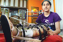 A Year After the Blast, a Life Crippled