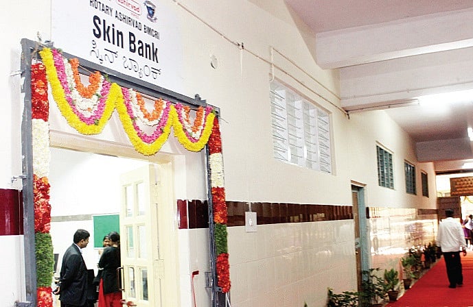 India\'s Second Biggest Skin Bank Opens in Bengaluru