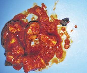 MTR gets notice after ‘bug in pickle’ complaint