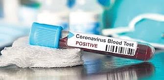 Nagpur civic body chief Tukaram Mundhe tests coronavirus positive