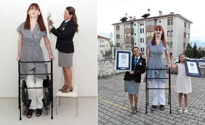 Meet Rumeysa Gelgi, the tallest living woman who stands over 7 feet