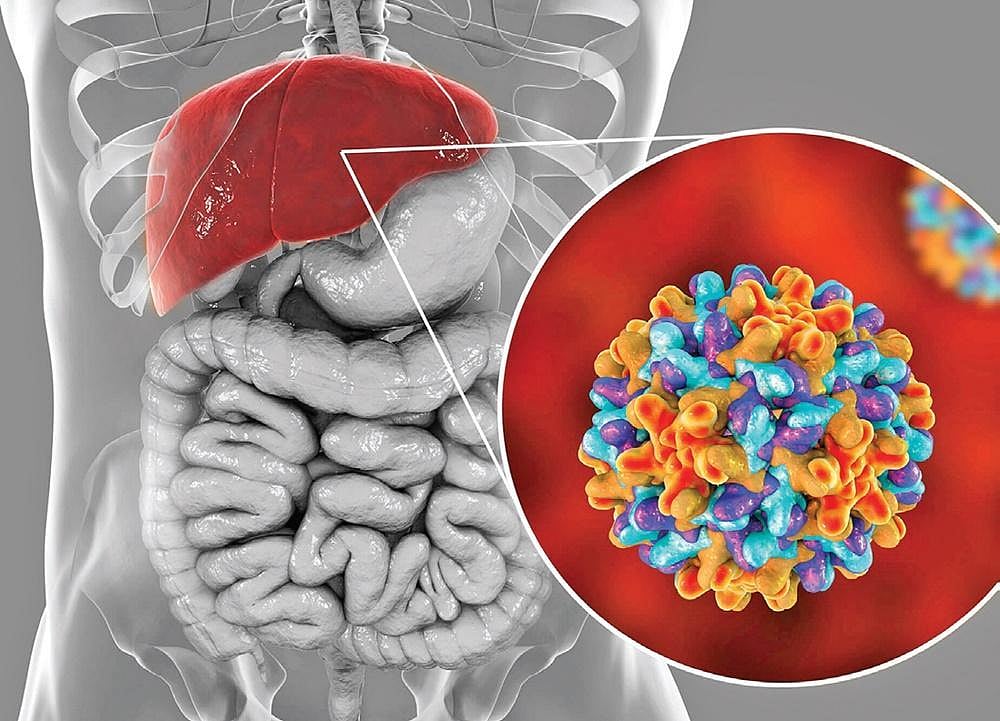 The what, why and how of hepatitis