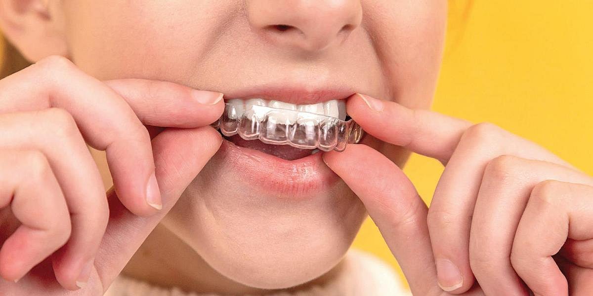 Dental disaster: Experts weigh in the causes of tooth decay