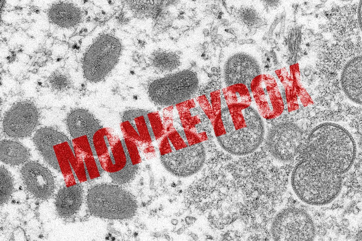 Kerala reports third monkeypox case as another UAE-returnee tests positive