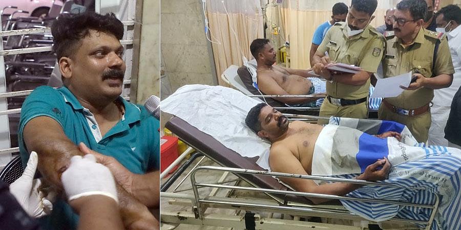 Man pours hot bitumen, three suffer burns