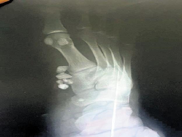 Wilhelm Rontgen: An X-Ray accidentally...