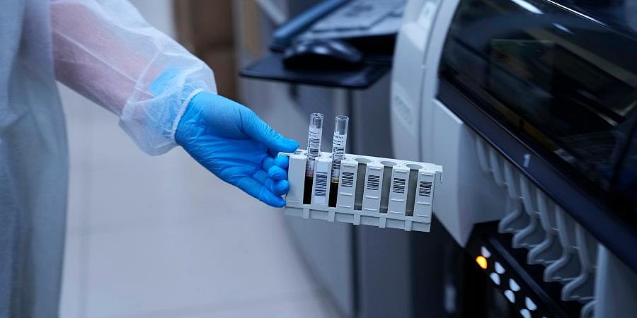 Drug testing lab in Odisha's Sambalpur to operate by year-end