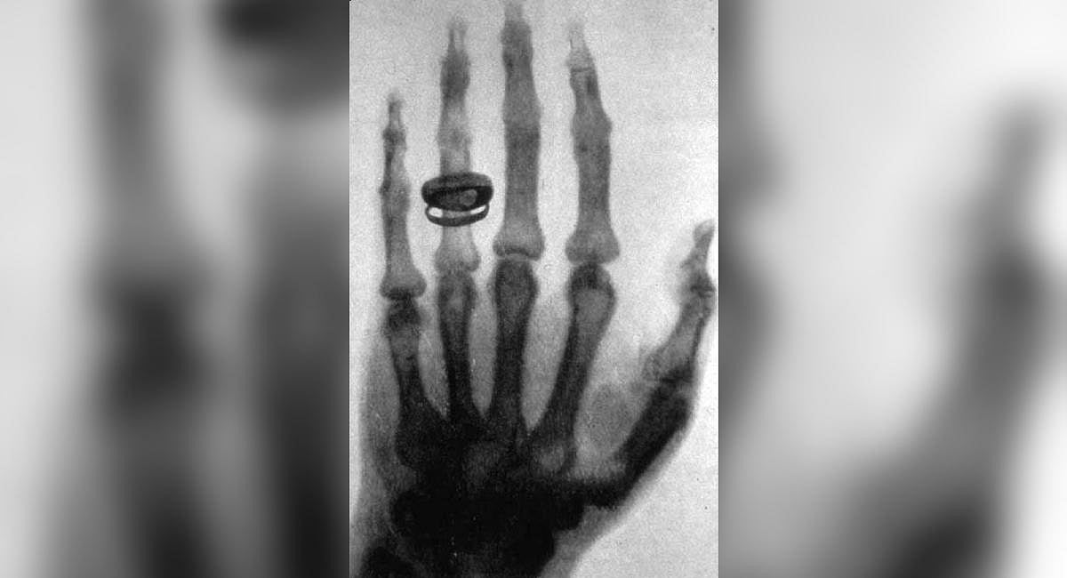 Radiology history and development