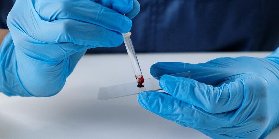 Cops turn to DNA test, send samples to identify father of murdered child