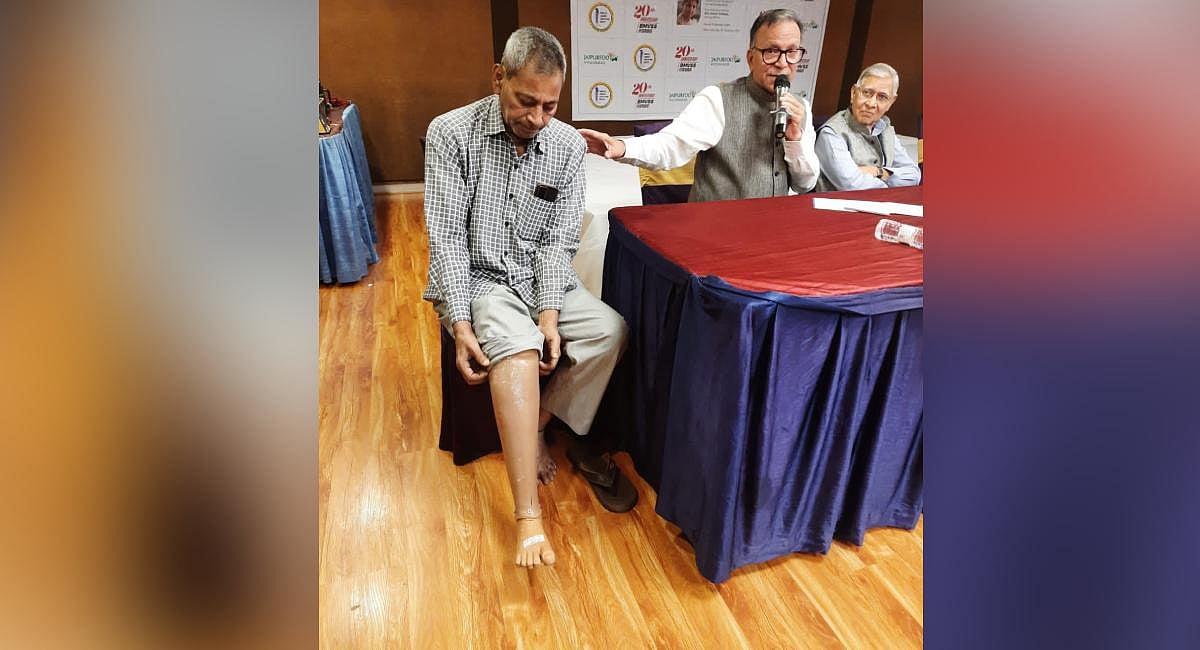 20 years on, Jaipur Foot makes life easy for amputees