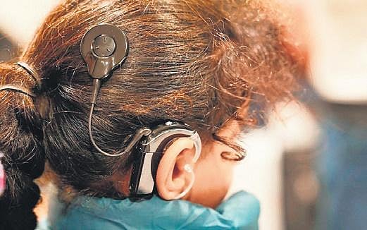 After long gap, Kerala govt approves funds to upgrade cochlear implant devices
