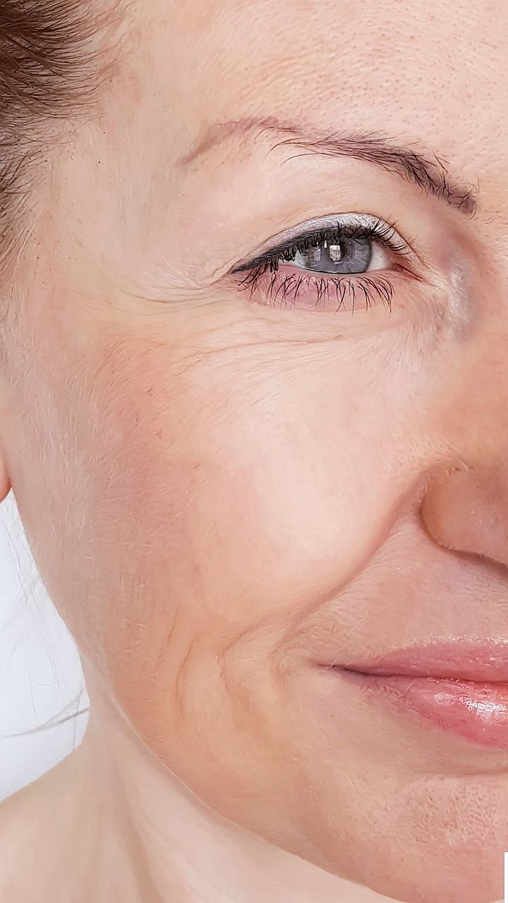 Ant-Aging Yoga । त्वचेच्या सुरकुत्या कमी करतील 'ही' योगासने । Reduce ...