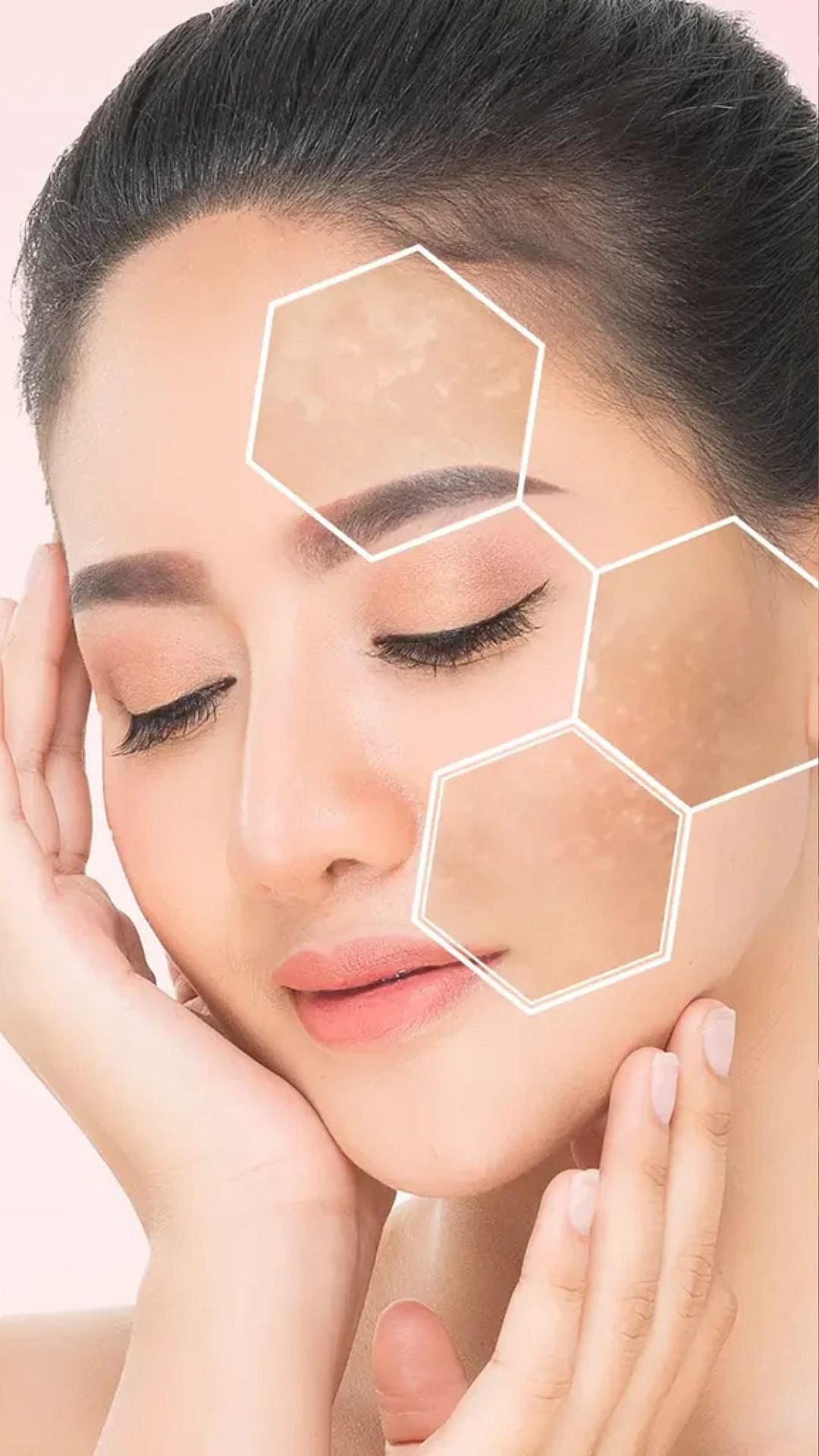 Dry skin Pigmentation : थंडीच्या दिवसात त्वचा काळी का पडते? | Dry skin ...