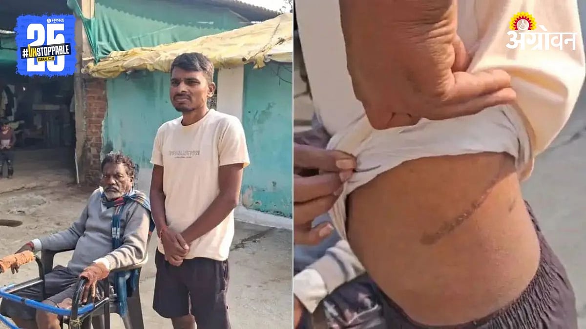 Kidney Sale Case | पंजाबचा हिमांशू किडनी विक्री प्रकरणात होता कार्यवाहक ...