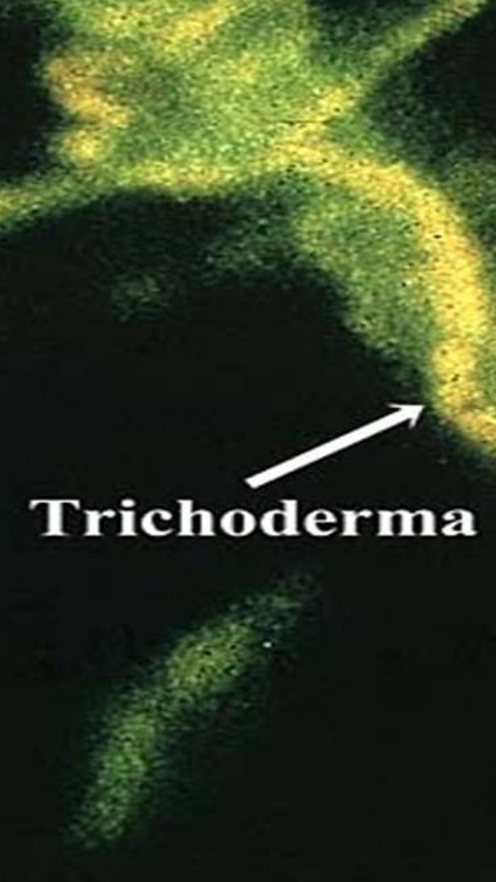 Trichoderma : जैविक बुरशी ट्रायकोडर्मा बुरशीजन्य रोगाचं नियंत्रण कसं ...
