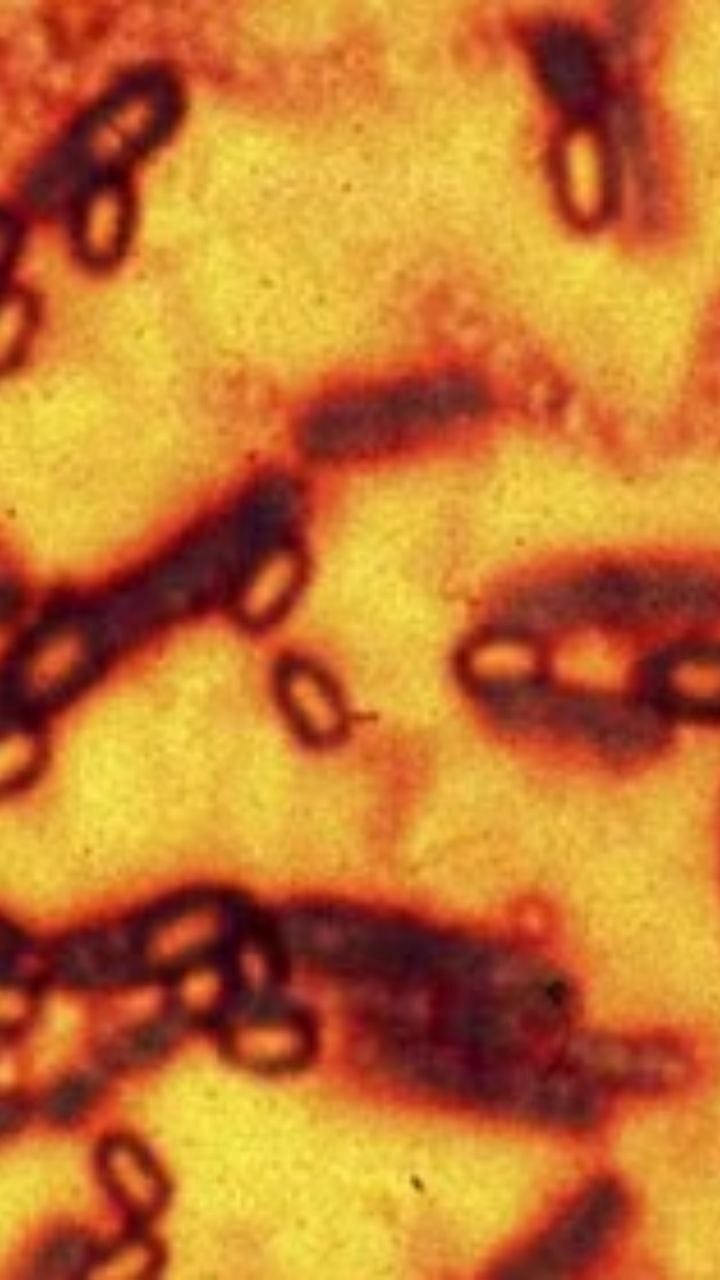 NOHM Mission |काय आहे नॅशनल वन हेल्थ मिशन? जूनोटिक रोगावर काय आहे मोहीम ...