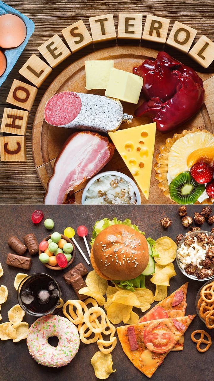 Signs Of High Cholesterol : कोलेस्टेरॉल वाढण्याची लक्षणे कोणती?