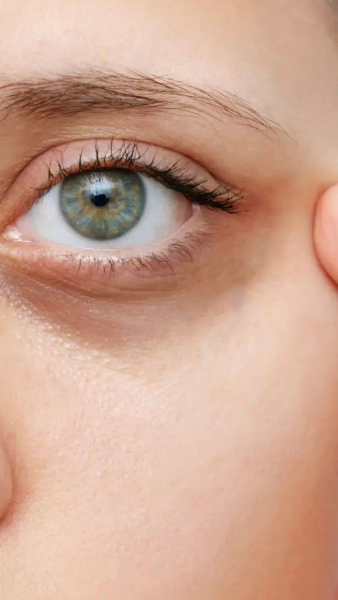 Eye Twitching Meaning : डोळा फडफडणे शुभसंकेत आहे की अशुभसंकेत? | Eye ...