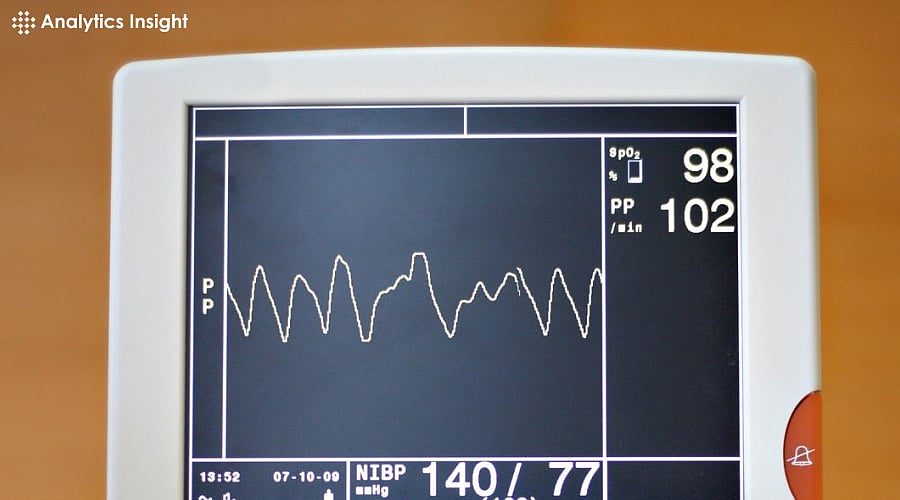 How AI Can Detect a Heart Attack?