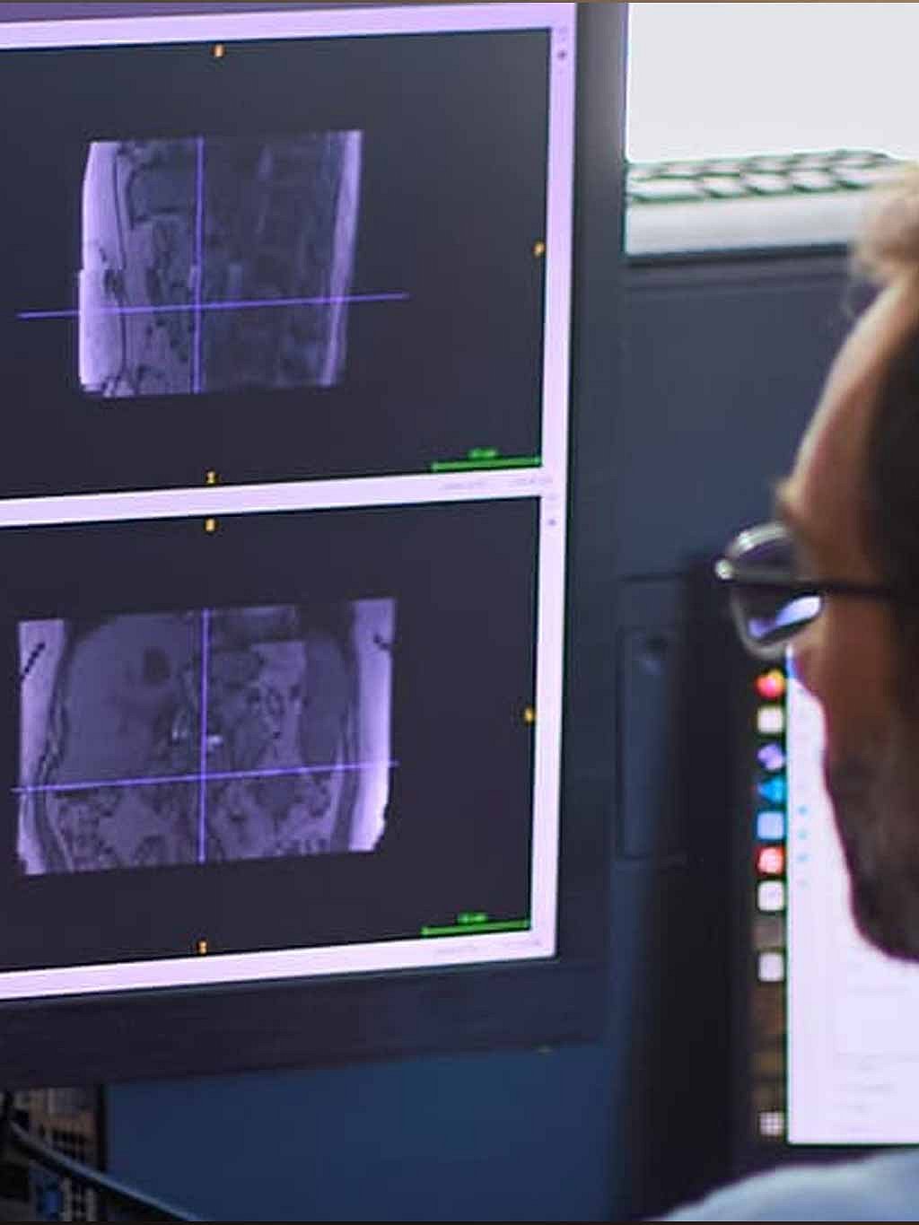 S&P Global Unveils AI Monitor Tool for NASH Treatment