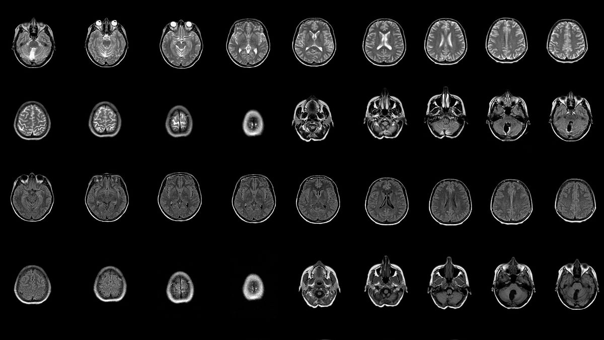 Video games that help the mind battle dementia