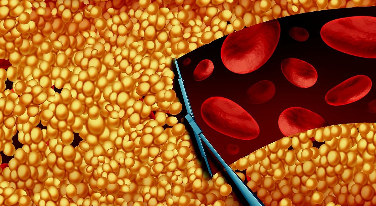 The ultimate victory of commercial interests over science – Prof Noakes ...