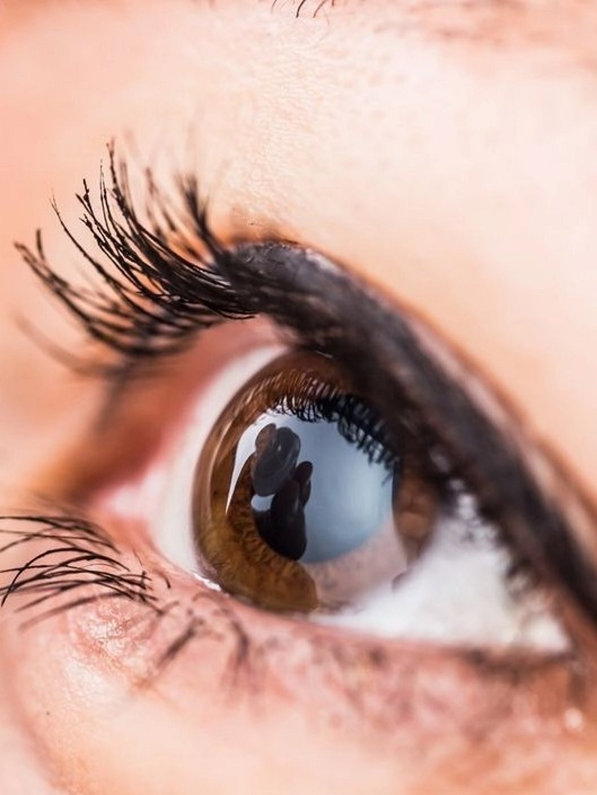 Viral Conjunctivitis: Symptoms & Prevention Tips To Be Aware Of As Pink ...