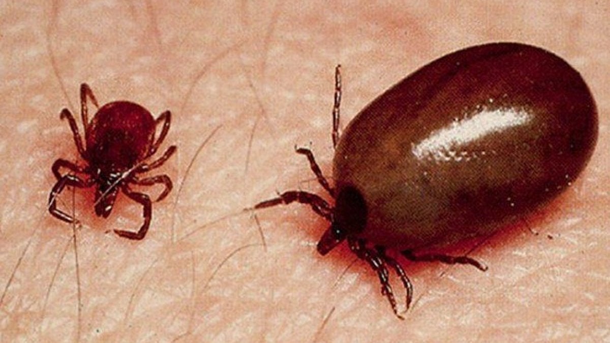 What Is Scrub Typhus? Know Symptoms, Diagnosis, And Treatment Of The ...