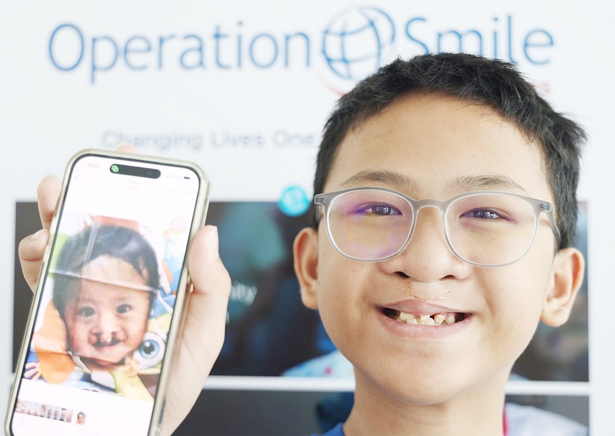 Making more confident smiles