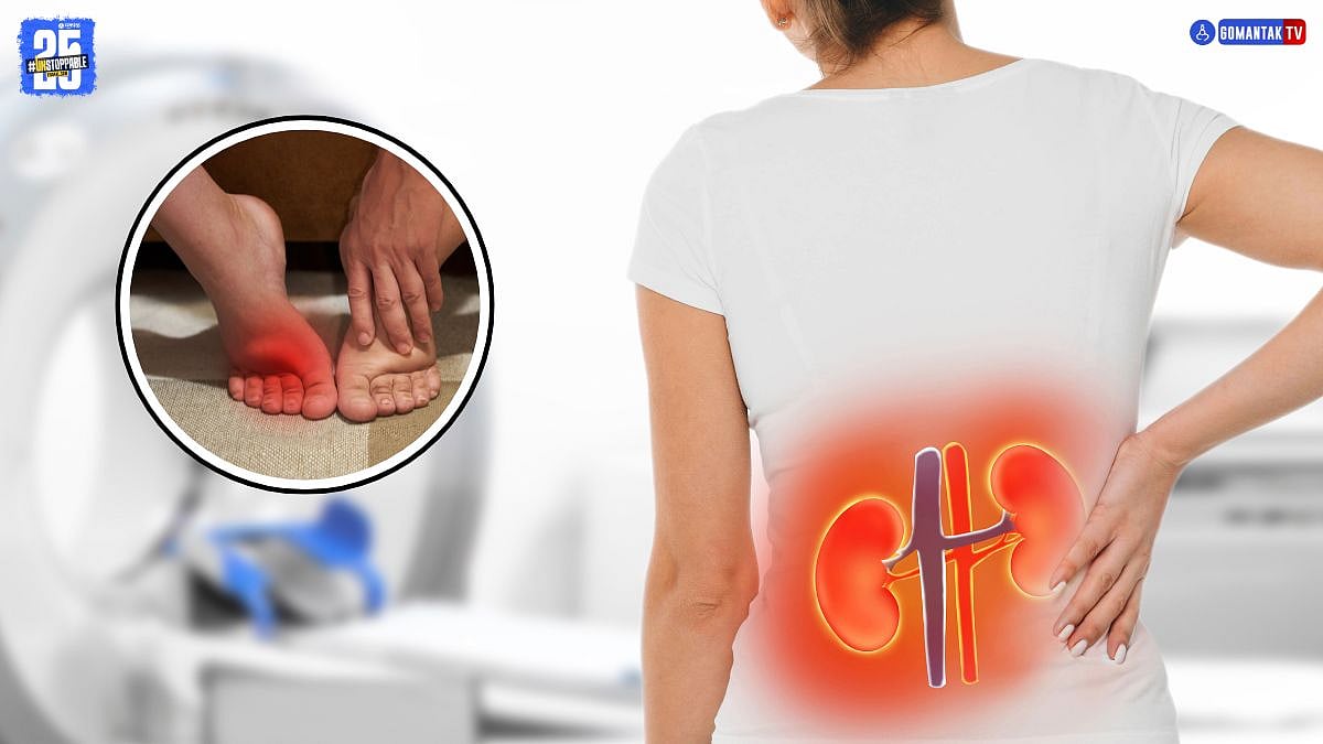 Kidney Damage Symptoms: किडनी खराब झाल्यावर पायांमध्ये दिसतात 'ही ...