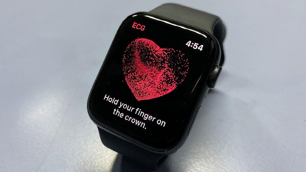 Apple Watch: Five key heart health tracking features you should know