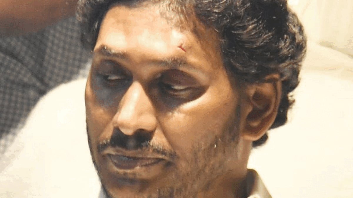 Andhra CM Jagan Mohan Reddy injured in stone pelting incident in Vijayawada