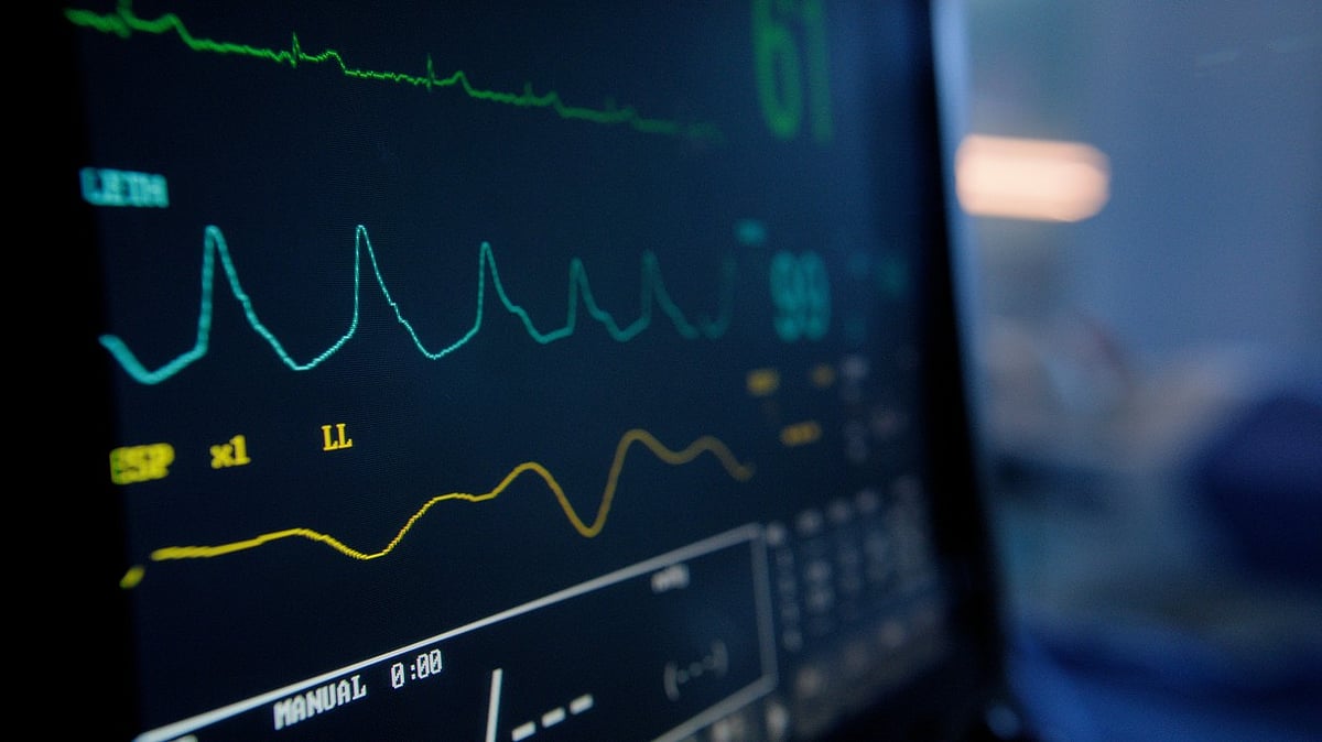 Woman's life saved, thanks to CAD Foundation’s satellite ECG network