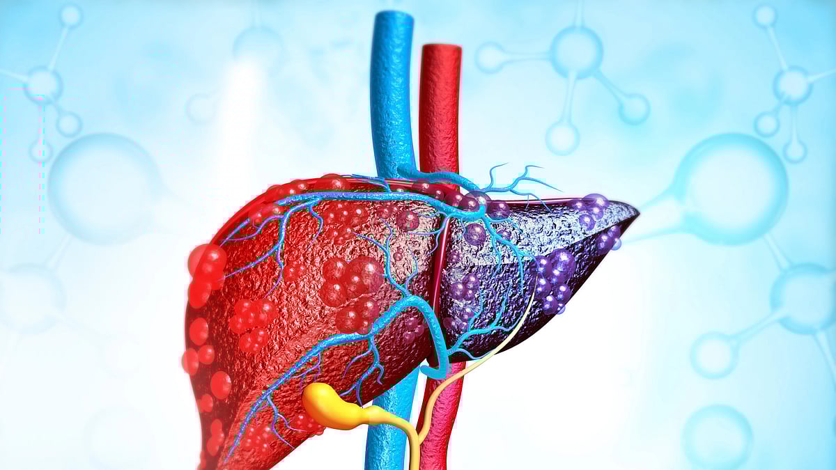 Hidden Fat Risk: Lean Yet at Risk of Fatty Liver, Doctors Warn