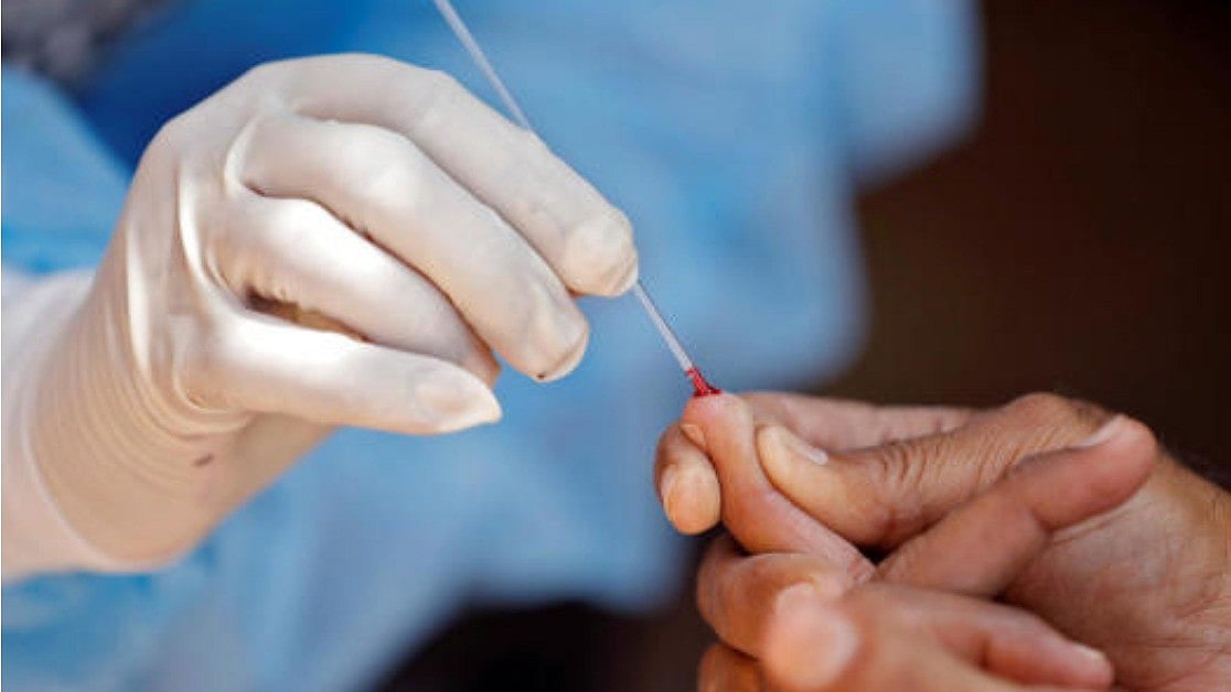 Bengaluru to get central drug testing lab, to cut wait time for sample ...