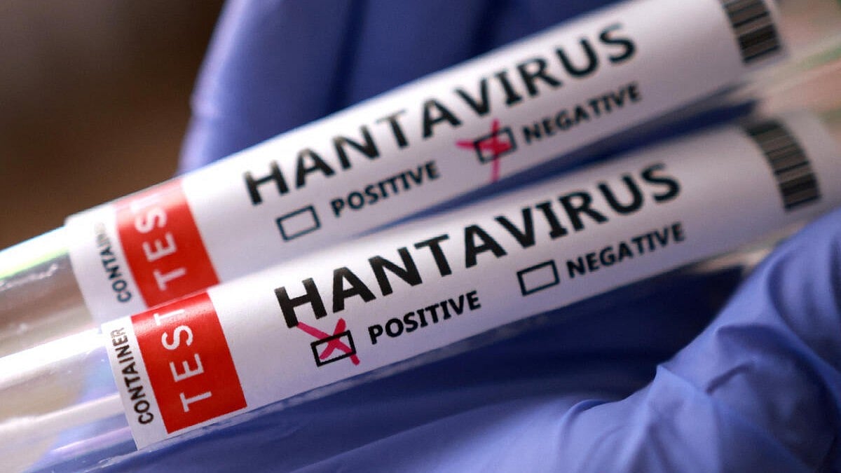 One US citizen tests mildly positive for hantavirus, another has mild ...
