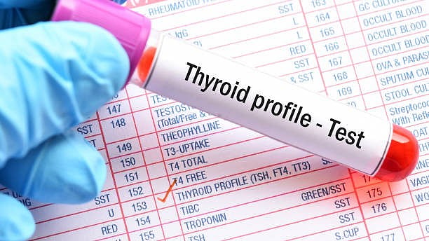 Doctors warn thyroid disorders emerging as hidden factor behind infertility