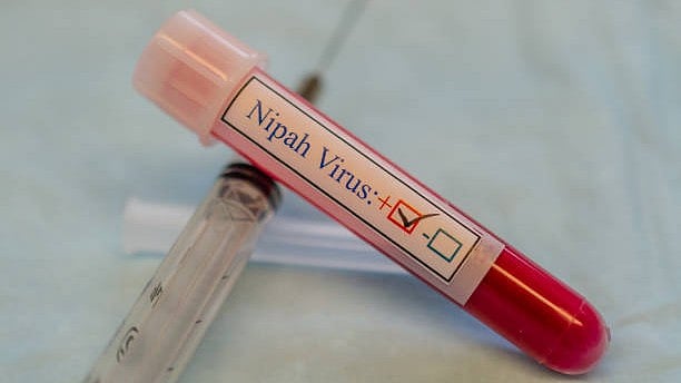 Kerala: Nipah patient still in critical condition, no fresh cases reported