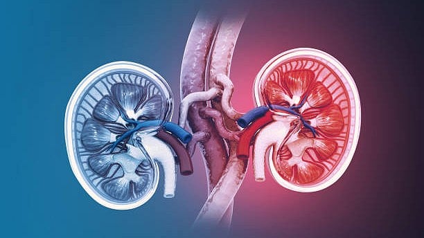 Kidney cancer: Do genes put you at risk?