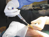 Bone and joint repair