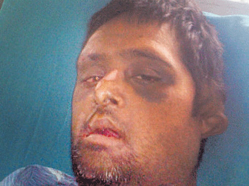 Brain-dead man's organs donated