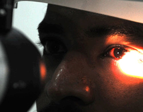 Half the world's population to be myopic by 2050: study