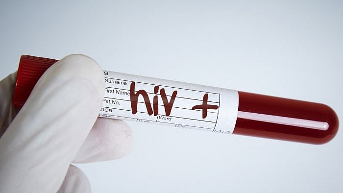 Karnataka sees drop in HIV cases over last 10 years