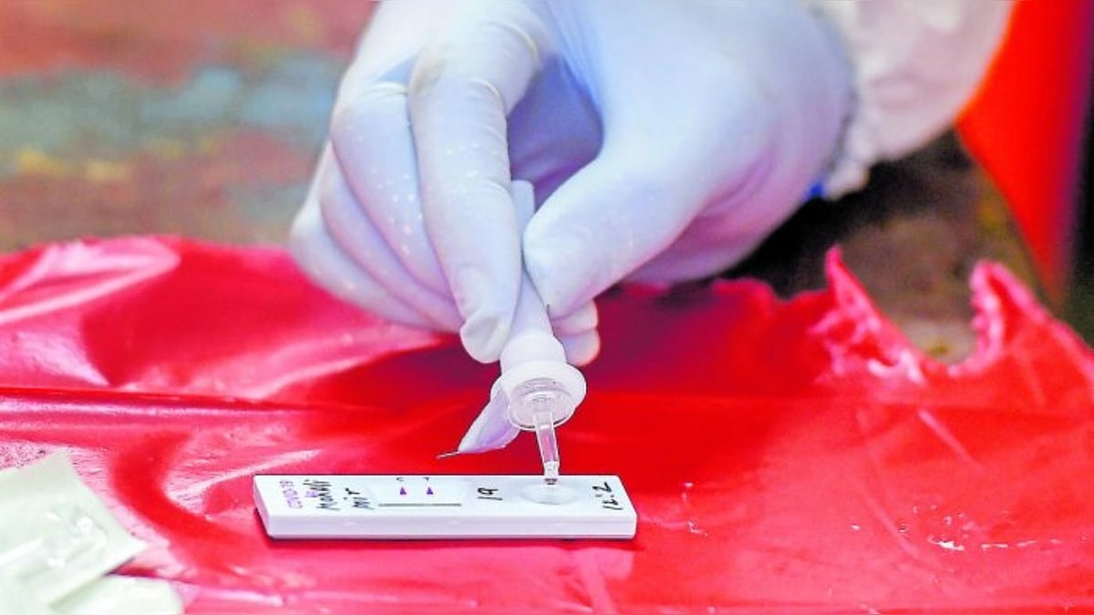 Self-test RAT kits for Covid causing reporting hesitancy