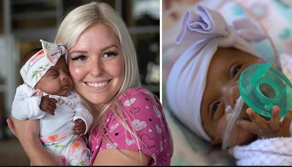 world's tiniest baby survives