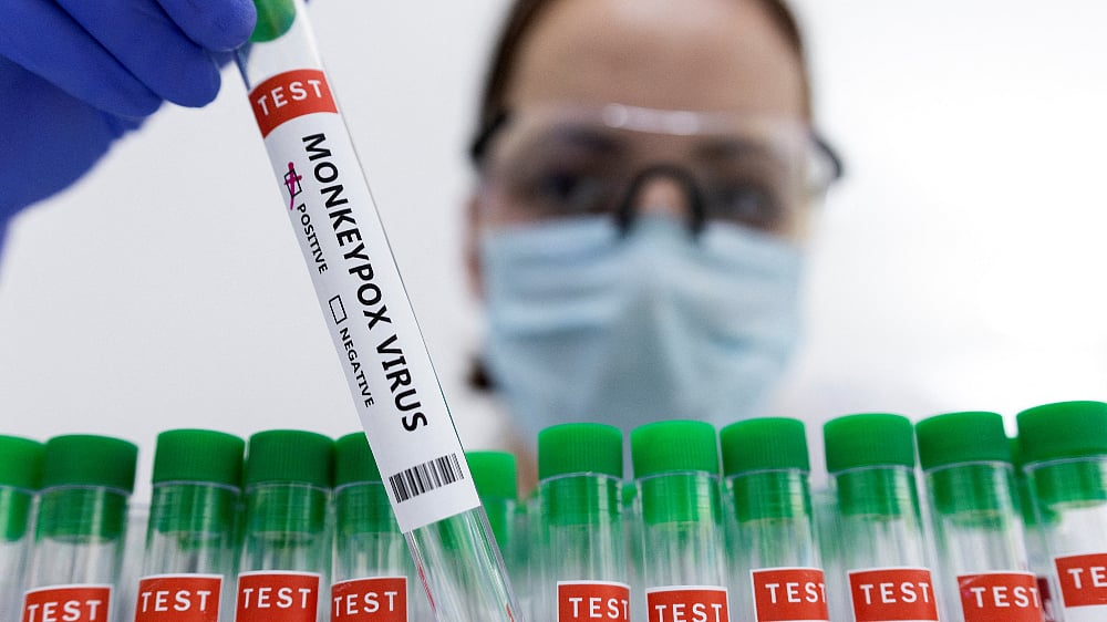 US expands monkeypox testing capacity amid rising cases