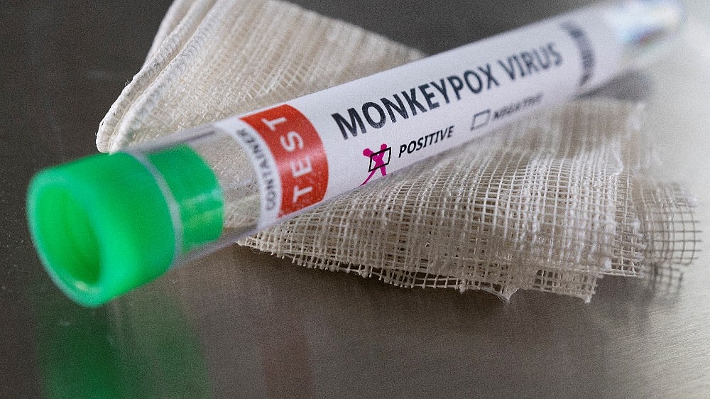 Centre issues guidelines for management of Monkeypox: Details here
