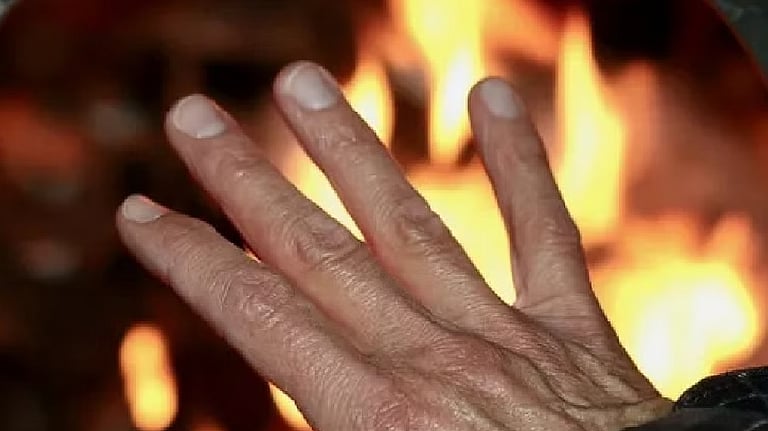 Elderly couple suffer burns in suspected suicide pact